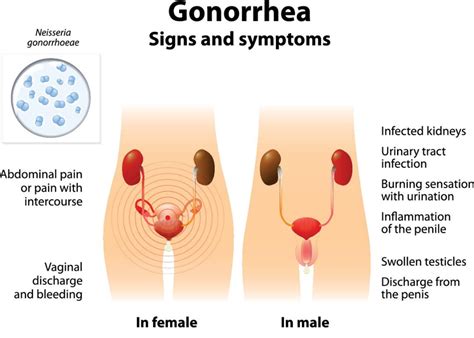 Std Education Morehouse School Of Medicine