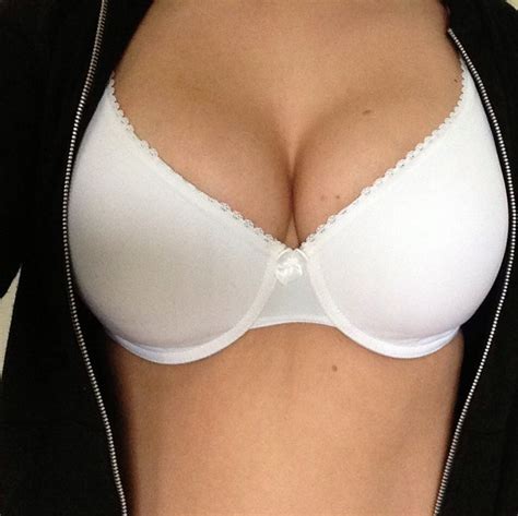 Oh So Natural 1 Year Post Op And Looking Phenomenal Dr Lees Patient