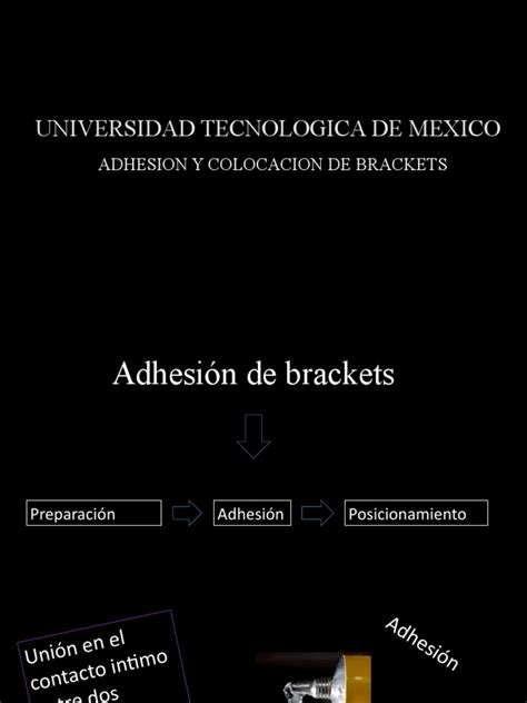 Adhesión De Brackets Pdf Adhesión Esmalte De Dientes