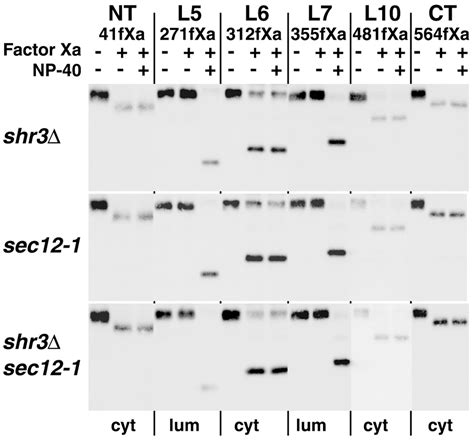 A Method For Determining The In Vivotopology Of Yeast Polytopic Membrane Proteins Demonstrates