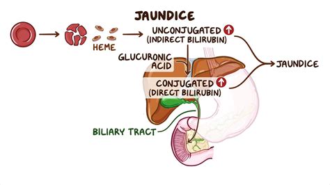 Fractionated Bilirubin