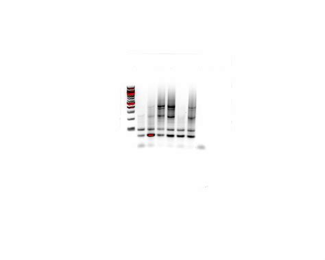 Hello What Could Be The Possible Ways To Troubleshoot Seeing Multiple Bands In Pcr Genotyping
