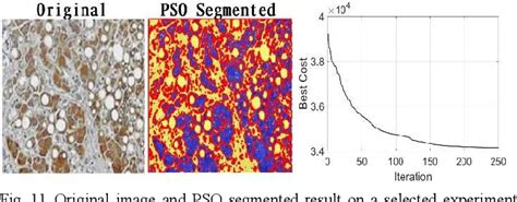 Figure 11 From Fatty Liver Level Recognition Using Particle Swarm Optimization Pso Image