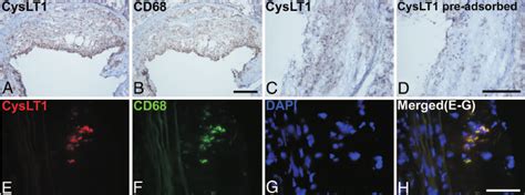 Expression Of Cyslt 1 Protein In Mouse Atherosclerotic Lesions A And