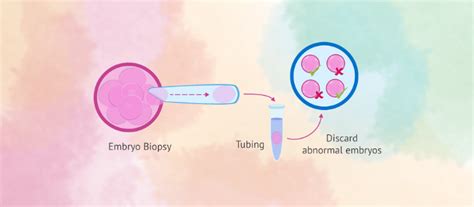 Embryo Biopsy And Pgt In Banjara Hills And Karmanghat Fertilica Ivf Centre
