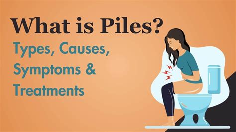 What Is Piles Types Causes Symptoms And Treatments