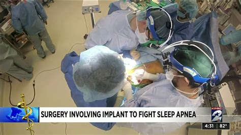 Surgery Involving Implant To Help Fight Sleep Apnea Youtube
