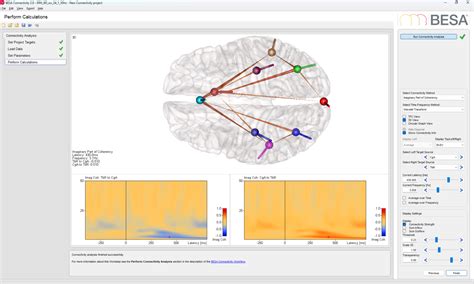 Besa® Brain Electrical Source Analysis Besa Connectivity Overview