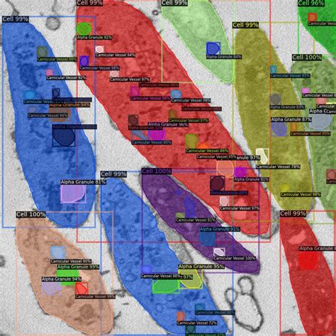 Sreenivas B On Linkedin Microscopy Deeplearning Bioimageanalysis Segmentation