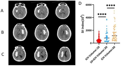 Representative Head Computed Tomography Ct Scan Of Patients With Download Scientific Diagram