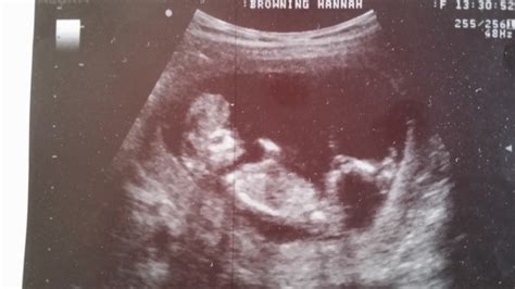 Married And Blindsided Congo Counseling Laguna Hills California