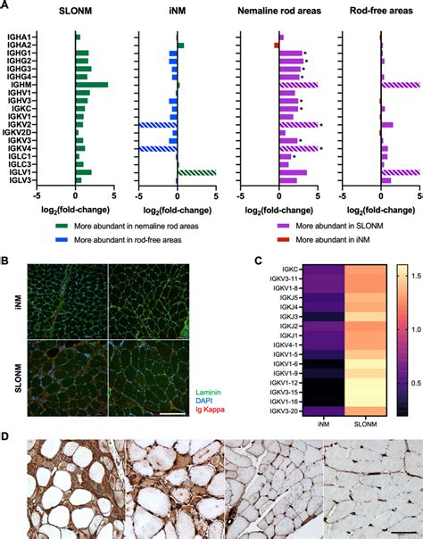 Analysis Of Immunoglobulin Expression And Autoimmune Markers In