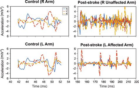 Raw Acceleration Data Extracted From The Left And Right Wrists Of A