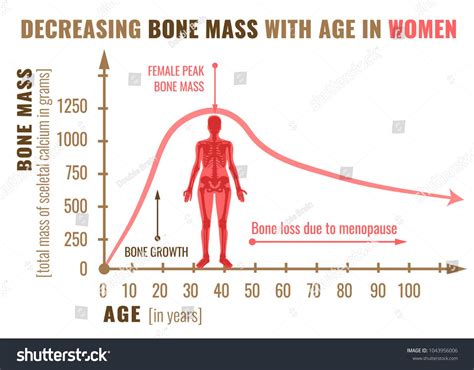 Decreasing Bone Mass With Age In Women Detailed Infographic In Beige