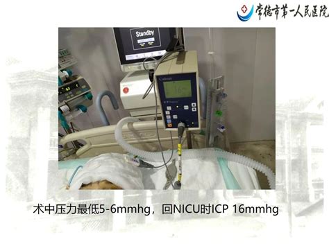 监测有道丨颅压监测下1例重型脑外伤的救治——颅脑创伤 神经重症周刊（第199期） 脑医汇