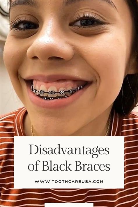Black Braces The Ultimate Guide To A Bold And Stylish Smile