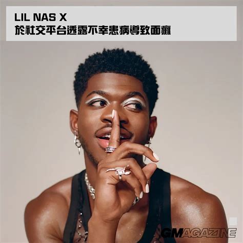 𝗚 𝗠𝗔𝗚𝗔𝗭𝗜𝗡𝗘 亞洲潮流生活總站💡 今日，lil Nas X 於社交平台透露自己突發右半邊面癱，完全無辦法動彈臉部肌肉
