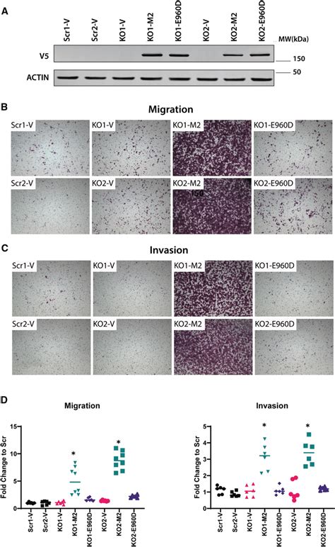 High Trpm2 Expression Increases Invasion And Migration In Download Scientific Diagram