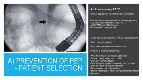 Post Ercp Pancreatitis Risk Factors Prevention Treatment Pptx