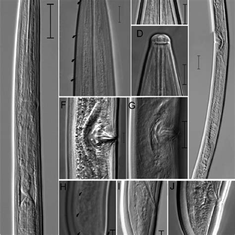 Xiphinema Japonicum N Sp A Female Pharyngeal Region B D Lip Region Download Scientific