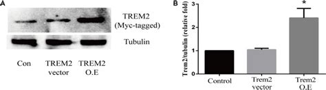 Microglial Trem2 Mitigates Inflammatory Responses And Neuronal