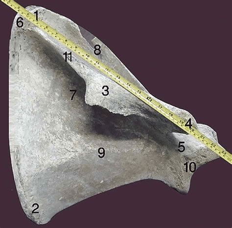 Lateral Aspect Of Right Scapula 1 Cranial Angle Angulus Cranialis