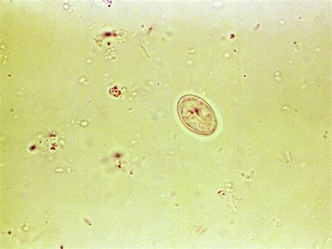 Giardia Lamblia Under Microscope