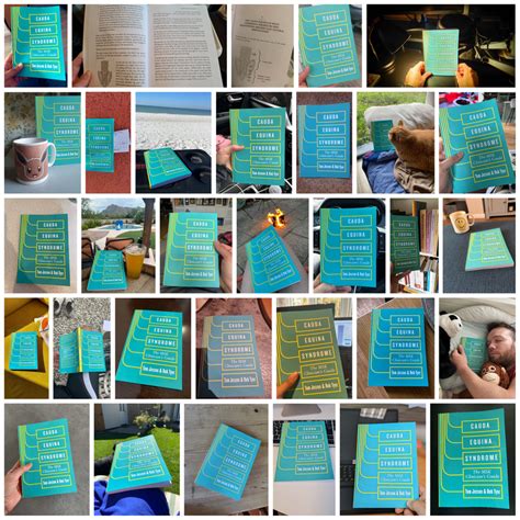 Cauda Equina Syndrome The Msk Clinicians Guide Tom Jesson Books