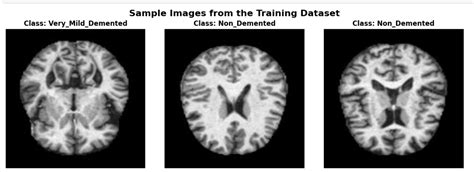 Github Praneet Prabhanjanbrainmrialzheimerclassification