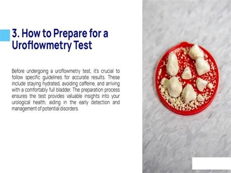 Understanding Uroflowmetry A Definitive Guide For Patientspptx