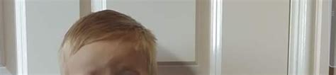Forehead Lump Really Worried Mumsnet