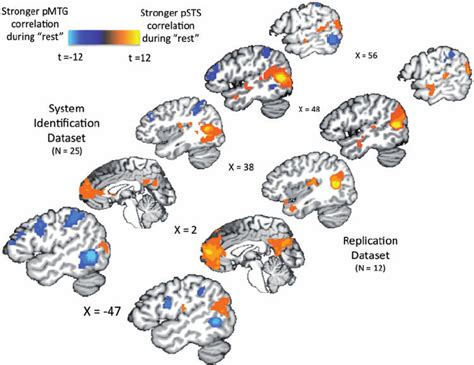 Random Effects Group Analyses Demonstrating Regions Of Differential