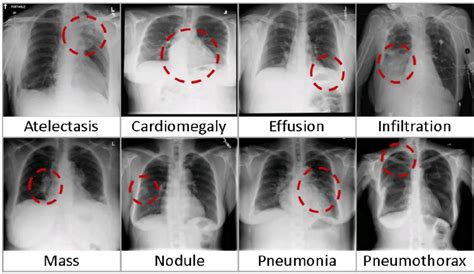 Advanced Image Classification Project Details