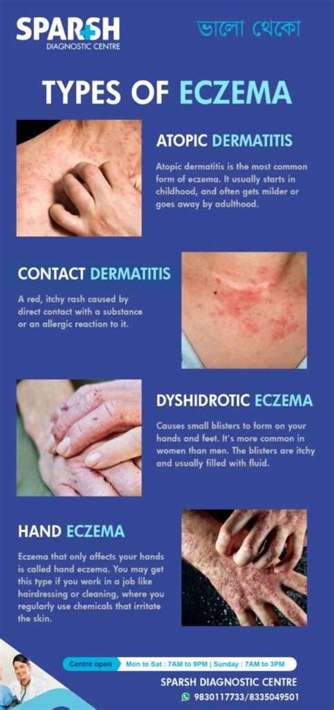 Contact Dermatitis Face Treatment