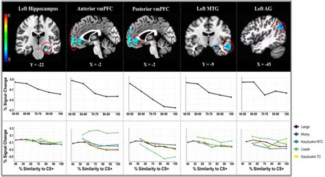 Activation Plots For Default Mode Network Regions Showing Negative