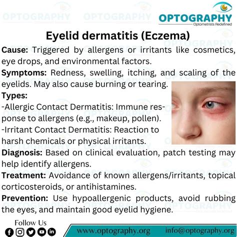Optography Eyelid Dermatitis Also Called Eyelid Eczema