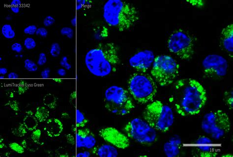 Lumitracker Lyso Green