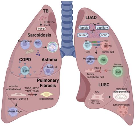 Spatial Transcriptomics In Lung Cancer And Pulmonary Diseases A Comprehensive Review Pmc