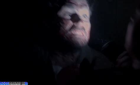 Parasite Enters Inside A Mans Body