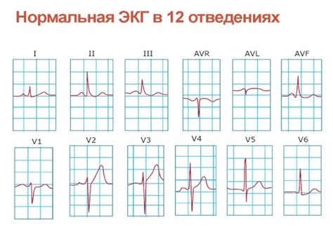 Подготовка пациента к экг исследованию алгоритм