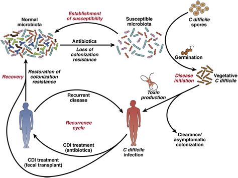 Fecal Microbiota Transplantation For The Management Of Clostridium