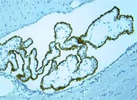 Mouse Leptin R Antibody R D Systems 100μg Unlabeledantibodies