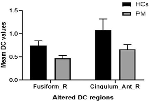 The Mean Values Of Altered Dc Values Between The Pm And Hcs Groups