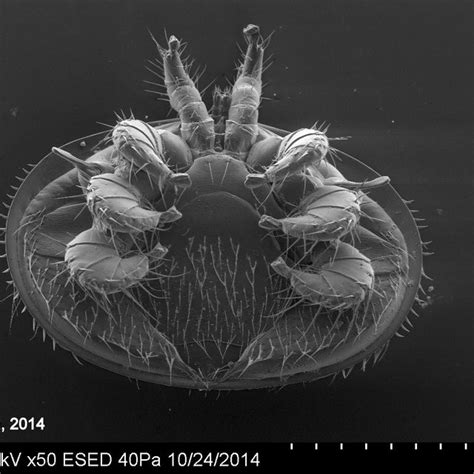 Electron Microscope Image Of Varroa Destructor Photo Leza M Download Scientific Diagram