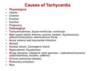 Tachycardia In Ecg Causes And Management Of Tachyarrhythmias Pptx