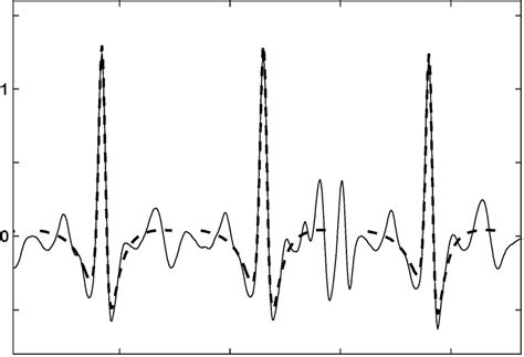 Rational Approximation Of Qrs Complexes The Dashed Curves Are Graphs Download Scientific