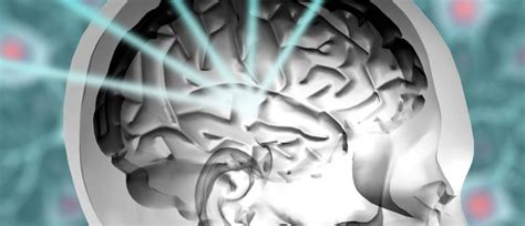 Stereotactic Radiosurgery For Brain Metastases And The Questionable Role Of Whole Brain Radiotherapy