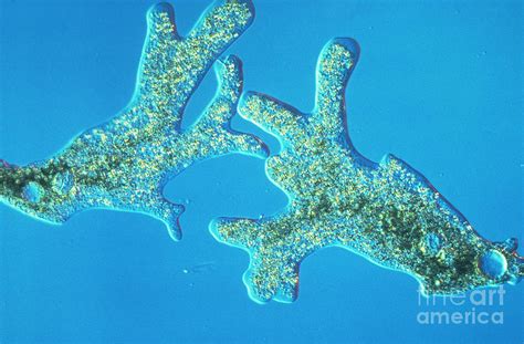 Amoeba Proteus Under Microscope