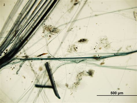7 Essential Steps To Ensure Best Results From Your Polarized Light