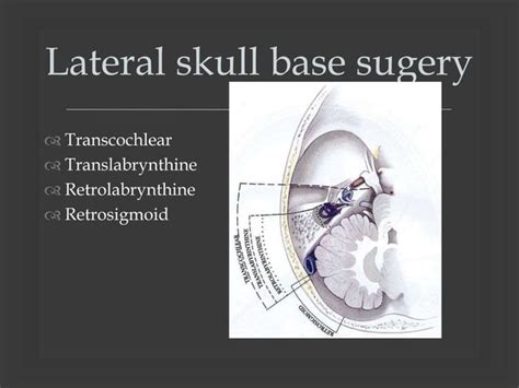 Skull Base Surgery Pptx